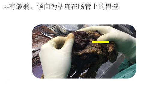 取材刀新手上路系列1 我猜 病理杂谈 91360病理论坛