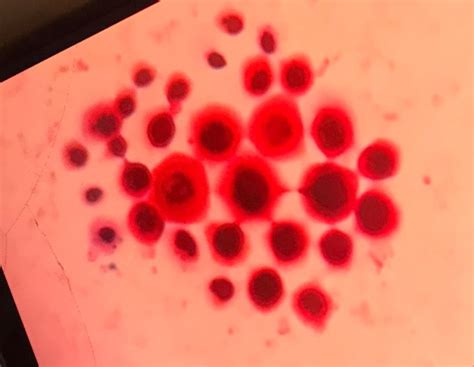 Mohamed Shakeeb On Linkedin Cryptococcus Neoformans A Mucoid Yeast Like Colonies Isolated From