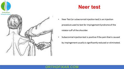 Subacromial Injection Test Explained Easily Orthofixar