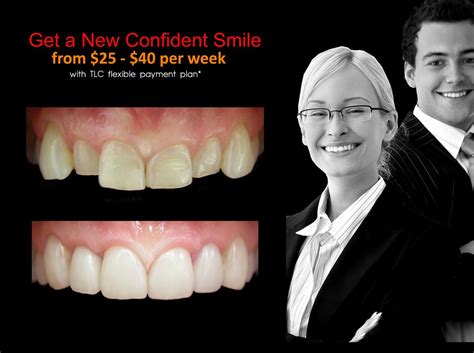 Beautiful Smile Treatment Composite Vs Porcelain Veneers