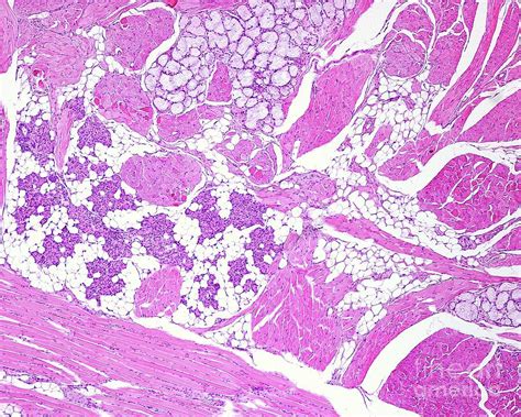 Forms Mucous Serous And Epidermal Membranes At Peggy Bergmann Blog