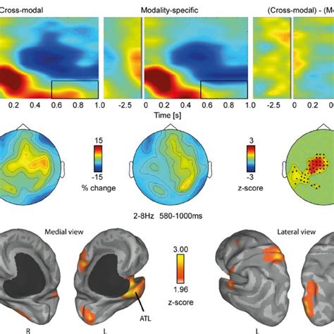 Low Frequency Oscillations In Sensor And Source Space A Total Power