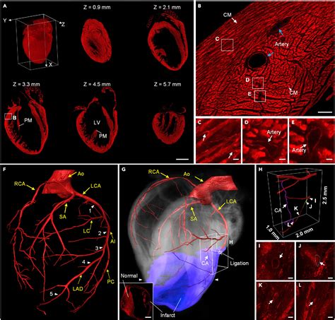 Cryo Fluorescence Micro Optical Sectioning Tomography For Volumetric Imaging Of Various Whole