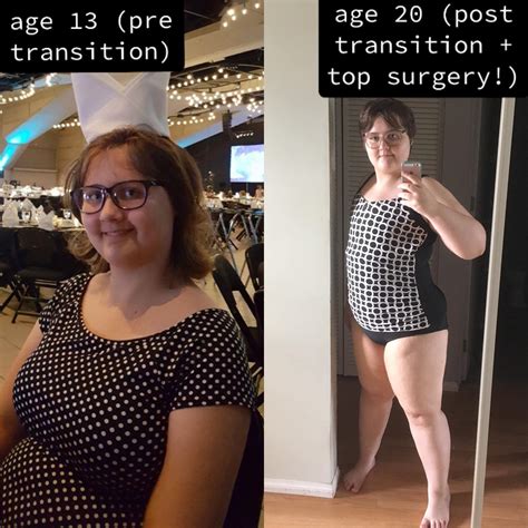 Female To Nonbinary Transition Never Took A Drop Of Hormones So Sorry