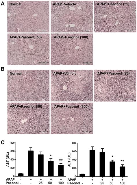 Pre Treatment With Paeonol Protected Against APAP Induced Liver Download Scientific Diagram