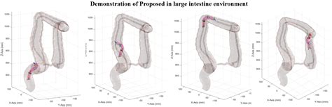 Soft Robotic Manipulator For Endoluminal Surgery Research Groups Imperial College London