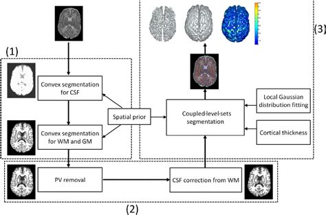 Figure 3 From Automatic Segmentation Of Neonatal Images Using Convex Optimization And Coupled