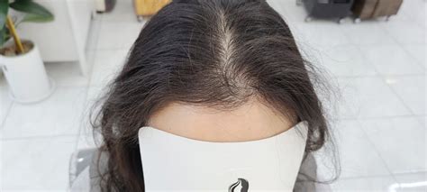 여자 앞머리 증모술로 숱 없는 앞머리 커버하기 네이버 블로그