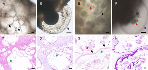 Establishment Of A Secondary Infection Laboratory Model Of Echinococcus