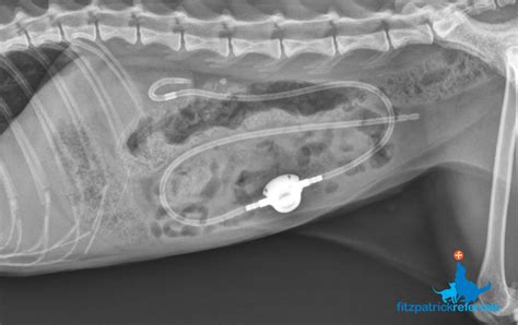 Subcutaneous Ureteral Bypass Sub Fitzpatrick Referrals Subcutaneous Ureteral Bypass Sub Fitzpatrick Referrals