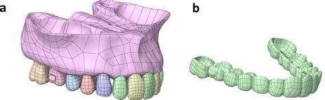 Finite Models A Models Of The Maxilla Periodontal Ligament Download Scientific Diagram
