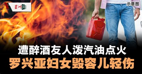 遭醉酒友人泼汽油点火 罗兴亚妇女毁容身体烧伤 国内 即时国内