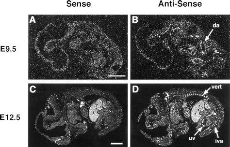 The Lklf Transcription Factor Is Required For Normal Tunica Media