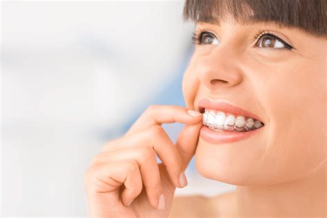 What To Expect With Invisalign Clear Aligners
