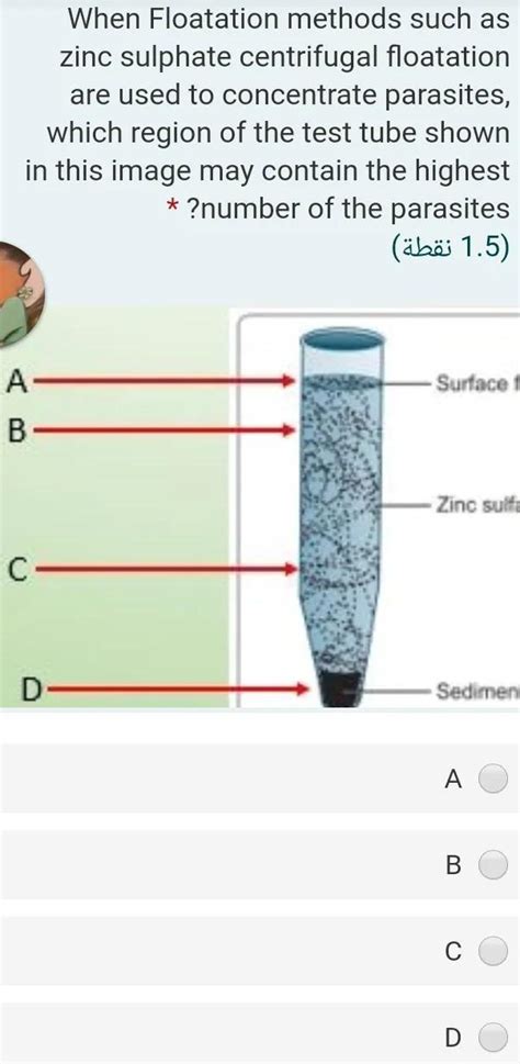 Solved When Floatation Methods Such As Zinc Sulphate