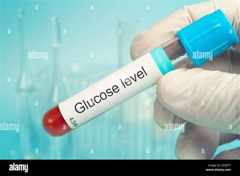 Fasting Plasma Glucose Test Hi Res Stock Photography And Images Alamy