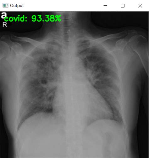 Deep Learning Klasifikasi Gambar Menggunakan Convolutional Neural Network Dengan Arsitektur