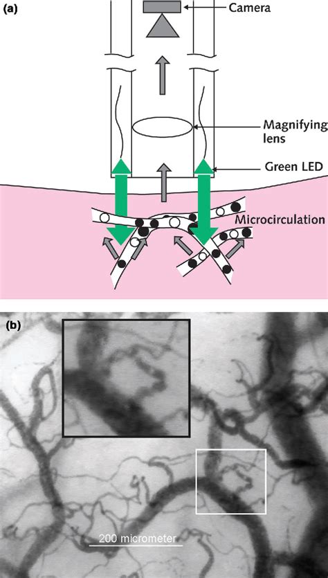 Pdf The Microcirculation Is The Motor Of Sepsis Semantic Scholar
