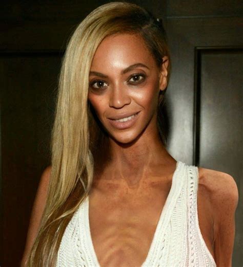 Anorexic Female Celebrities