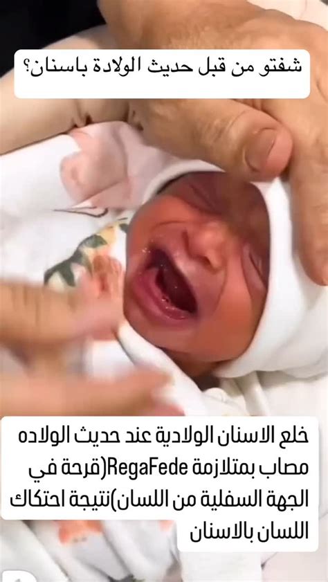 Doc Zou Draouraghfz • Instagram Photos And Videos