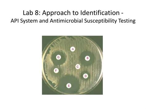 PPT Lab Approach To Identification API System And Antimicrobial Susceptibility Testing