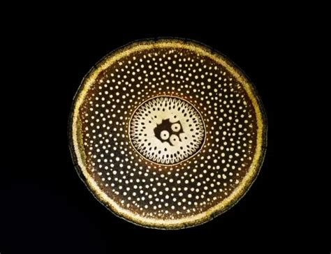 Light Micrograph Lm A Transverse Section Of A Root Of