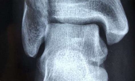 骨骼、关节健康 生命周期健康 法道营养草本网站