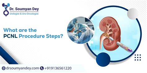 Side Effects Of Urethral Stricture Dilation