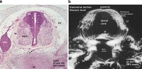 Maximum Matrix Formation Perineural Vascular Plexus Start Of