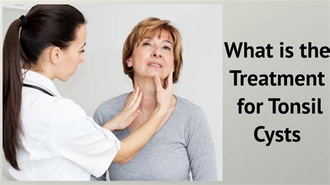What Is The Treatment For Tonsil Cysts Youtube