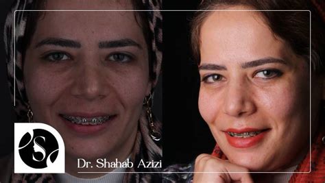 درباره کلینیک دکتر شهاب الدین عزیزی