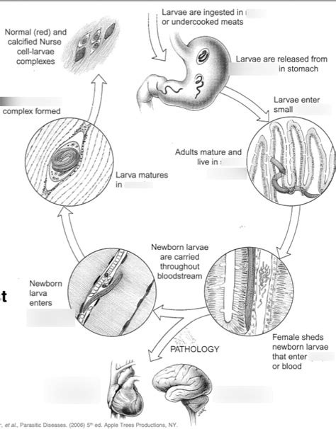 Diagram Of Trichinella Spiralis Life Cycle Quizlet