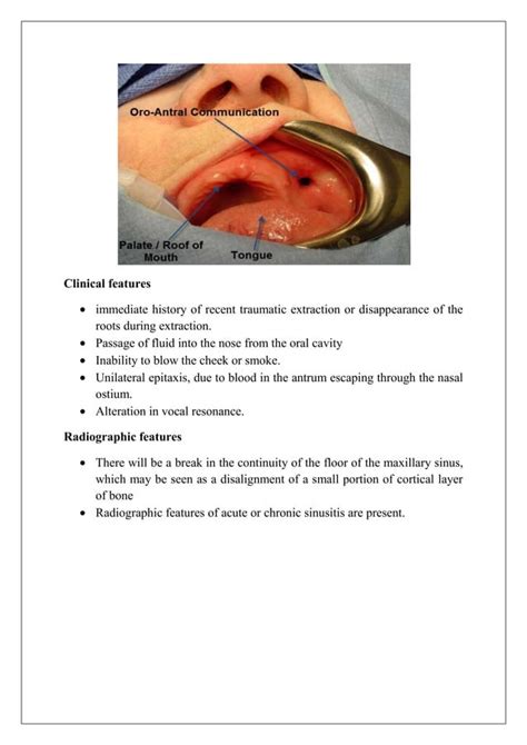 Differiential Diagnosis Of Maxillary Sinus Pathology Docx