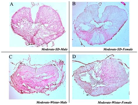 Sex And Strain Specific Variations In Motor Recovery Following