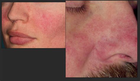 Shouldnt Diffuse Maps Be 100 Free From Shadows 2 By 0451 Materials And Textures