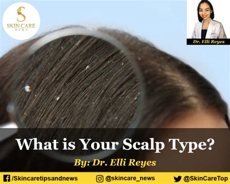 What Is Your Scalp Type