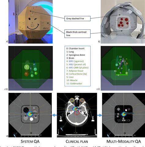 Figure 1 From End To End Testing For Stereotactic Radiotherapy