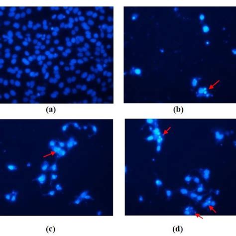 Fluorescent Microscopy Of Nucleus Stained With Dapi A Control Download Scientific Diagram