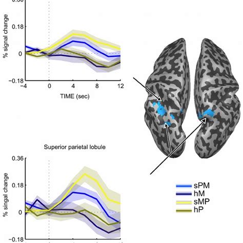 Tectal Beaking In Midsagittal Structural Mri Slices For A Control
