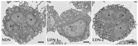 Representative Transmission Electron Micrographs Showing Normal Density Download Scientific