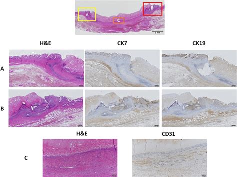 A Duodenum Side And B Liver Side Of Hematoxylin And Eosin Hande Download Scientific
