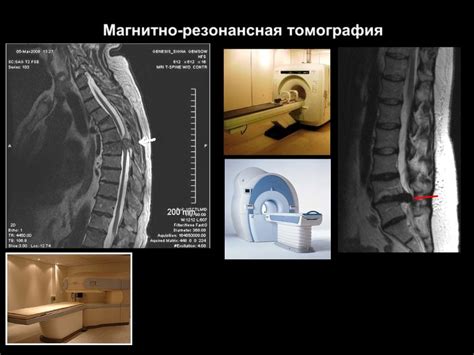 Компьютерная томография позвоночника