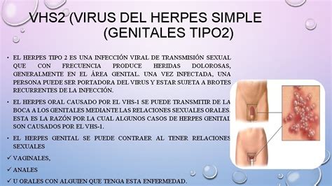 Historia Natural Del Herpes Agente Vhs 1 Herpes