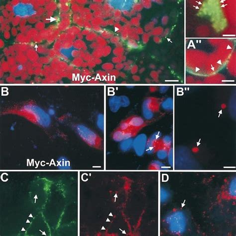 Axin Binds To Apc And Induces Apc Phosphorylation In Vivo A Diagram Download Scientific