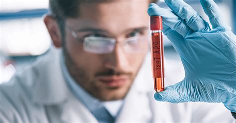 Your Elevated Psa Test Doesnt Automatically Mean Cancer