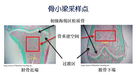 骨形态计量学分析案例