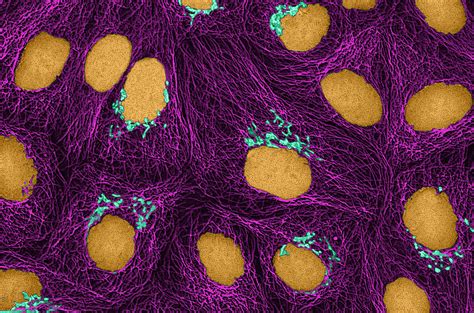 Hundreds Of Cancer Papers Mention Cell Lines That Dont Seem To Exist