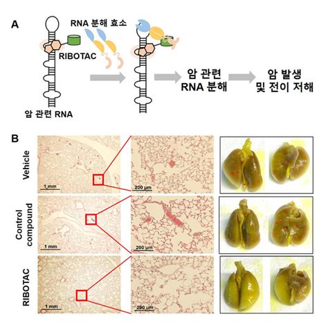 암 발생·전이 분해 화합물 개발난치병 치료 가능해진다