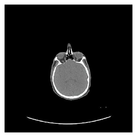 Using Measures To Select Optimal Edge Detection Algorithms A