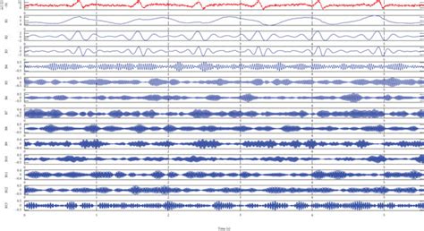 Vmd Decomposition Results Of The Pli Free Signal Download Scientific